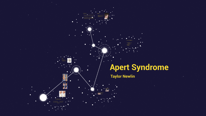 Apert Syndrome by TAYLOR NEWLIN on Prezi