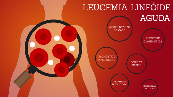 Patologia Clínica I - Leucemia Linfóide Aguda by Jayme João Campos on Prezi