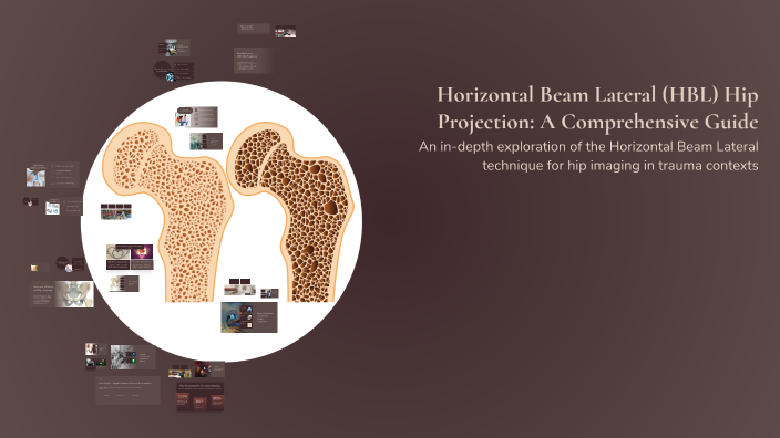 Horizontal Beam Lateral (HBL) Hip Projection: A Comprehensive Guide by ...