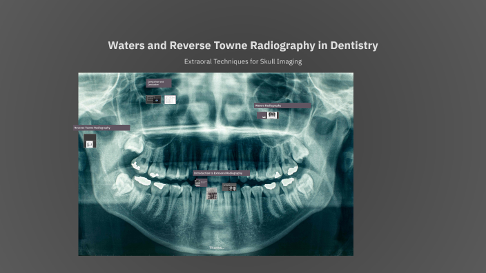 Waters and Reverse Towne Radiography in Dentistry by Parsa Partovi on Prezi