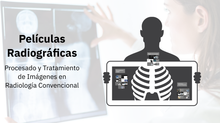 Películas Radiográficas by MJ G on Prezi