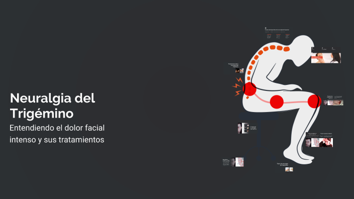 Neuralgia del Trigémino by Salinas Angel Irvin Alberto on Prezi