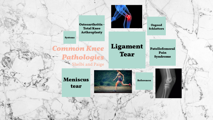 Common Knee Pathologies by shelbi clawson on Prezi