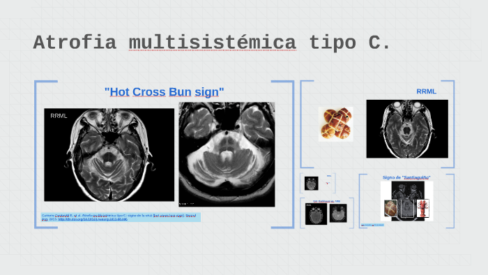 "Hot Cross Bun sign" by Elizabeth Varela on Prezi