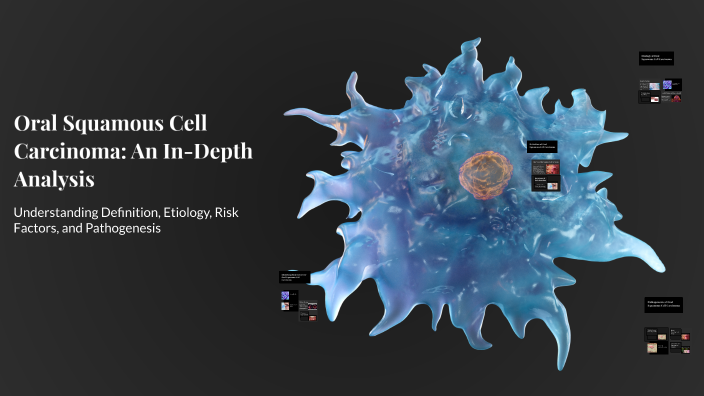 Oral Squamous Cell Carcinoma: An In-Depth Analysis by nik roslan on Prezi
