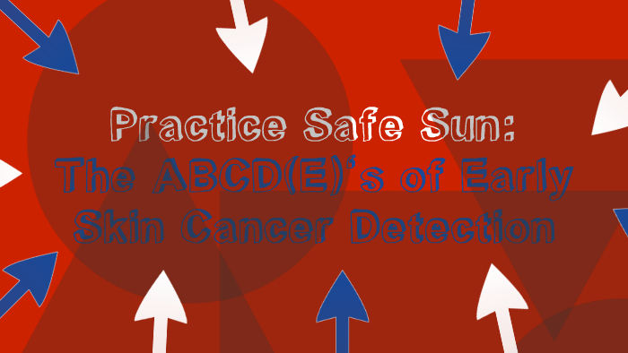 Practice Safe Sun: The ABCD Method of Early Skin Cancer Detection by ...