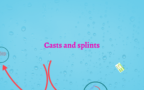 Casts and splints by Brandon Unger