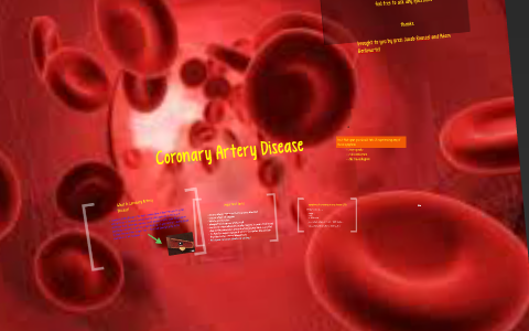 Coronary Artery Disease by Adam Roussel on Prezi