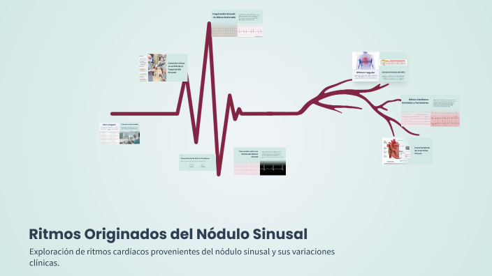 Ritmos Originados del Nódulo Sinusal by Germa Cruz on Prezi