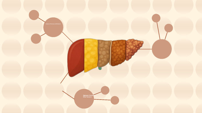 Mind Map ''Liver Cirrhosis'' by noura alkaabi on Prezi