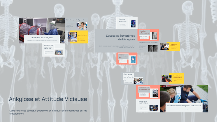 Ankylose et attitude vicieuse by Alix Tanchoux on Prezi