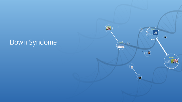 Down Syndome by Taylor Berger on Prezi