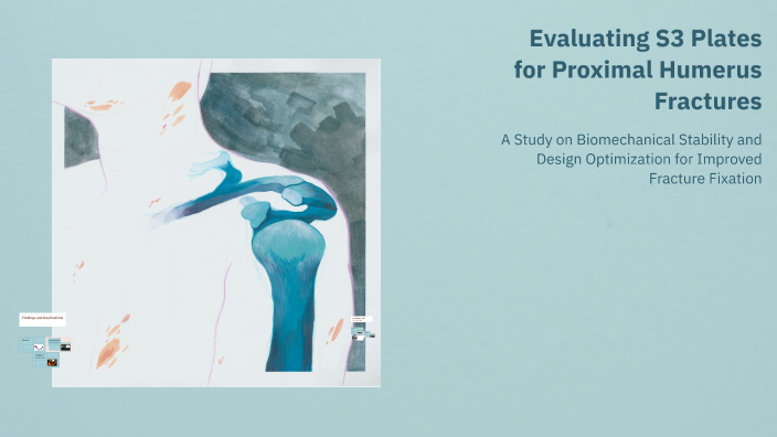 Evaluating S3 Plates for Proximal Humerus Fractures by Hashim Ali on Prezi