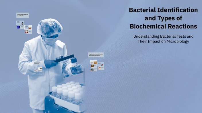 Bacterial Identification and Types of Biochemical Reactions by Vergil ...