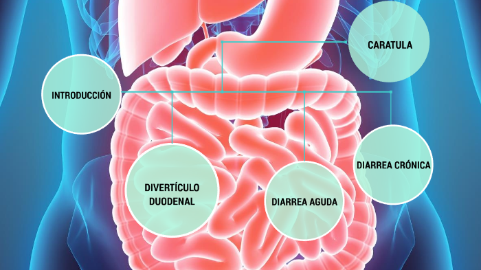 DIVERTICULO DUODENAL by Walter Tambo on Prezi