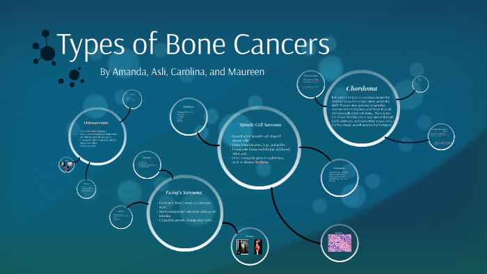 Types of Bone Cancers by Maureen Camara on Prezi