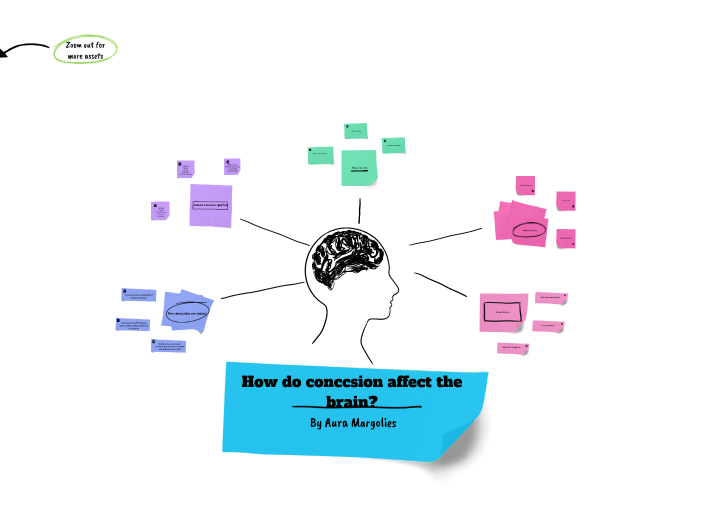 How Do Concussion Affect The Brain By Jonny Apple Seed On Prezi