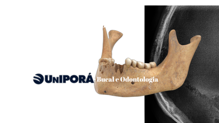 Anatomia e Fisiologia do Osso Alveolar by weverton Luiz Silva Santos on ...
