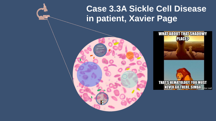 Case 3.3A Sickle Cell Disease by Christopher Yee on Prezi