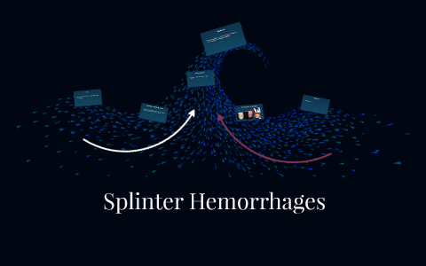 Splinter Hemorrhages by Yesenia Ruvalcaba on Prezi