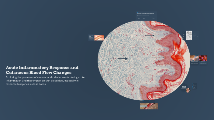 Acute Inflammatory Response and Cutaneous Blood Flow Changes by kiley ...