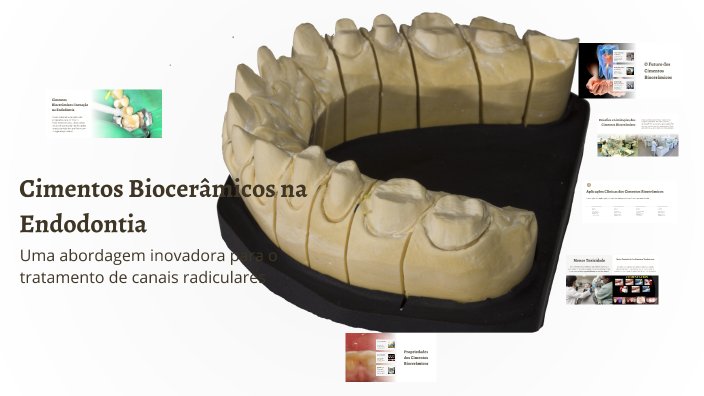 Cimentos Biocerâmicos na Endodontia by FLAVIO MACHADO BARBOSA on Prezi
