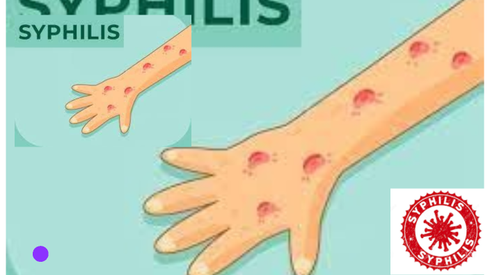 Syphillis by deejaie Christie on Prezi