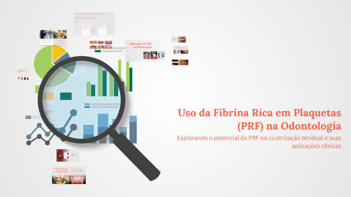 Uso da Fibrina Rica em Plaquetas (PRF) na Odontologia by Lailson ...