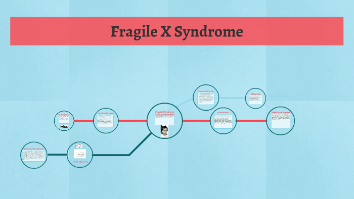 Fragile X Syndrome by Dylan Simmonds on Prezi