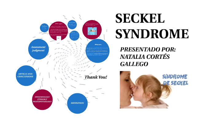 SINDROME DE SECKEL by NATALIA CORTES GALLEGO on Prezi