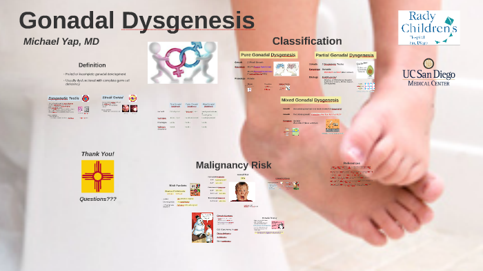 Gonadal Dysgenesis by Michael Yap on Prezi