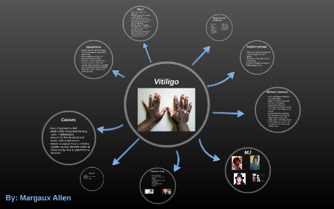 Vitiligo by Margaux Allen on Prezi