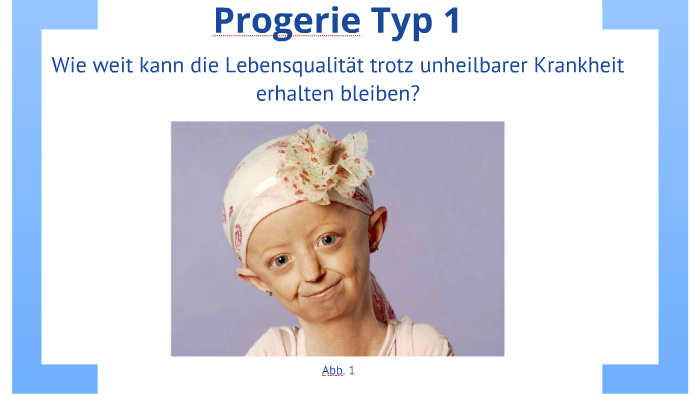 Progerie by kim leska on Prezi