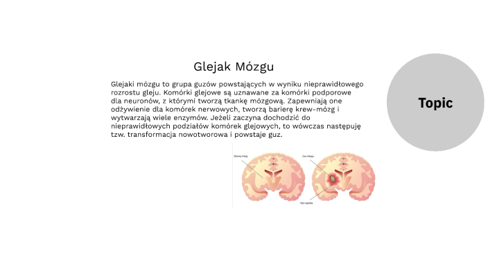 Glejak Mózgu by Krystian Drożdż on Prezi
