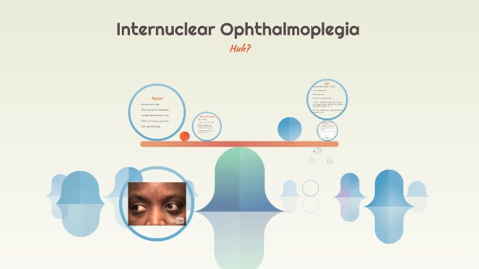 Internuclear Ophthalmoplegia