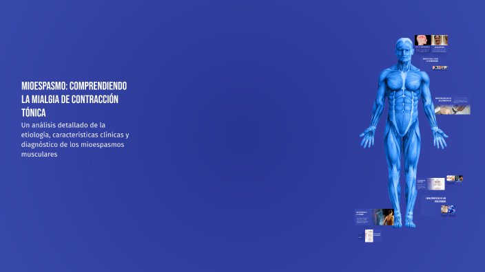 Mioespasmo: Comprendiendo la Mialgia de Contracción Tónica by luis ...