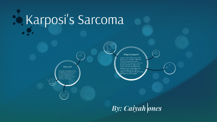 Karposi's Sarcoma by Caiyah Jones on Prezi