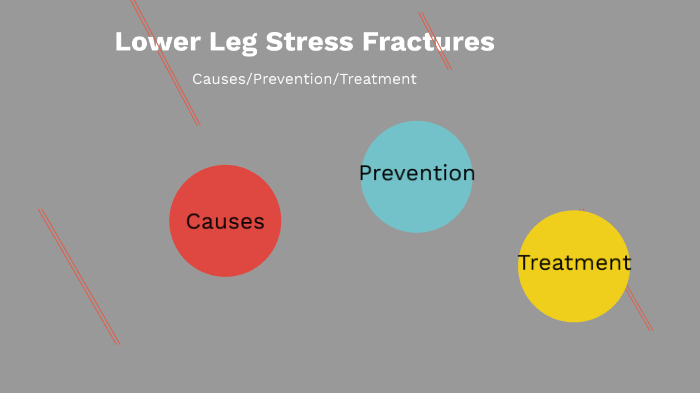 Lower Leg Stress Fractures by Emilee Pierce on Prezi