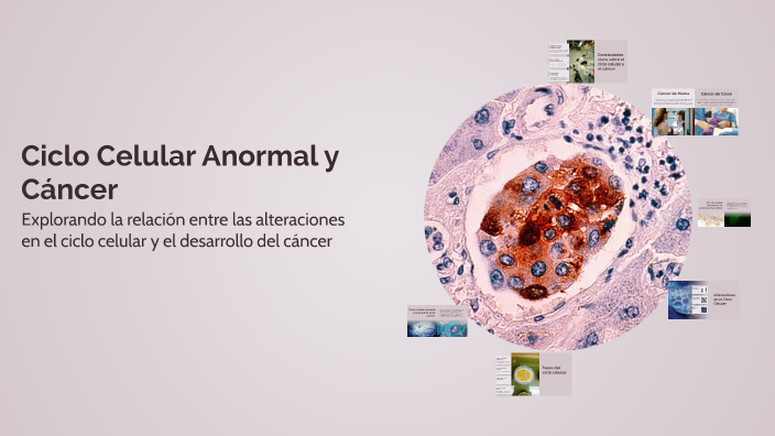 Ciclo Celular Anormal y Cáncer by Luci Milagros Huamani Huaman on Prezi