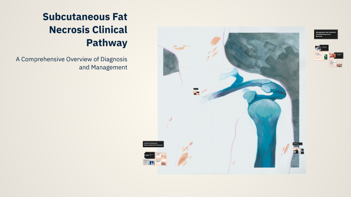 Subcutaneous Fat Necrosis Clinical Pathway by ali alghamdi on Prezi