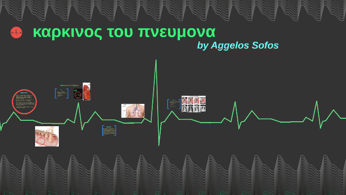 καρκινος του πνευμονα by Aggelos Sofos on Prezi