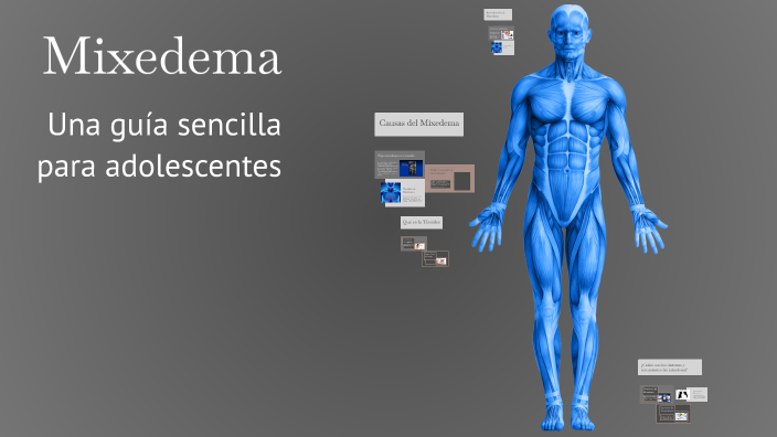 Mixedema by a a on Prezi
