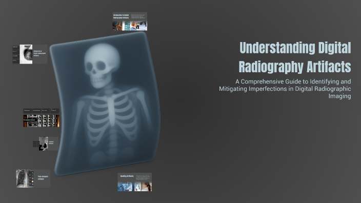 Understanding Digital Radiography Artifacts by abhishek bhatt on Prezi