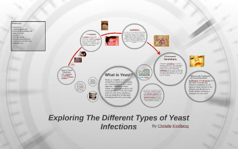 Exploring The Different Types of Yeast Infections by
