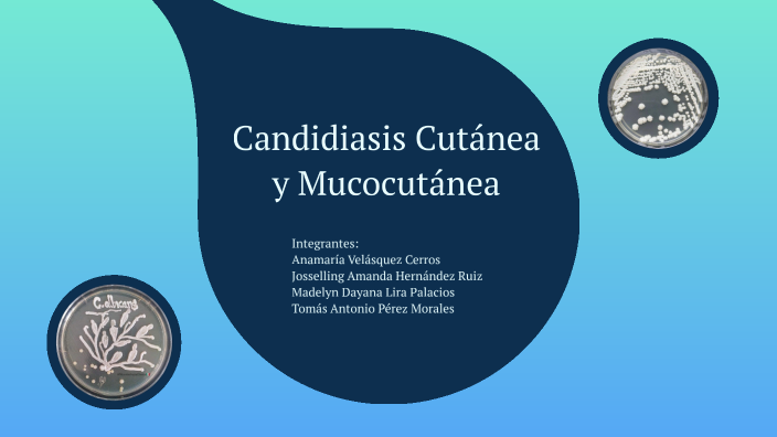 Candidiasis Cutánea y Mucocutánea by CHRISTIAN MANUEL AGUILAR SAENZ on ...
