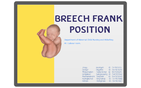 Breech frank position by Senerio pt on Prezi