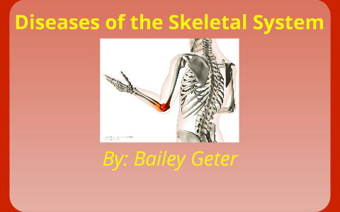 Diseases of the Skeletal System by William Mason on Prezi