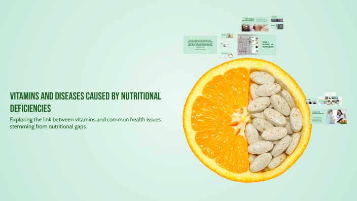 Vitamins and Diseases Caused by Nutritional Deficiencies by Øwfy on Prezi