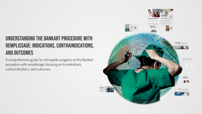 Understanding the Bankart Procedure with Remplissage: Indications ...