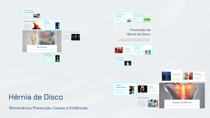 Hérnia de Disco by carlos silva on Prezi